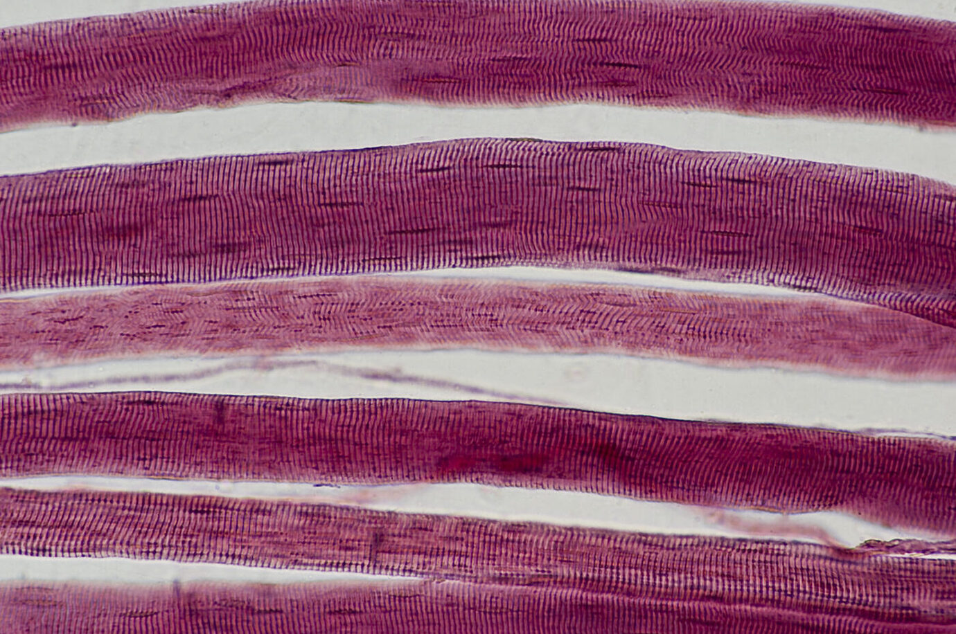Study identifies factor in 'young blood' that helps rejuvenate aged ...