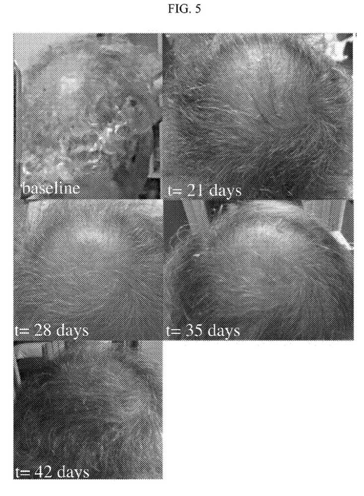 Reverse Gray Hair, Hair Repigmentation - Rapamycin Longevity News