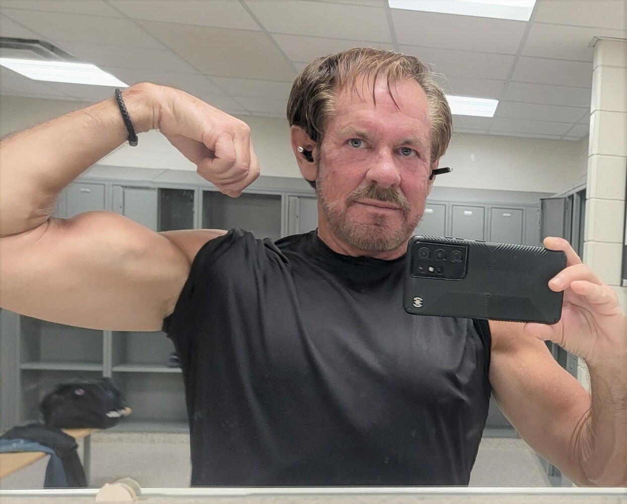 Bryan Johnson's Longevity Protocol - Your Thoughts? - Rapamycin ...