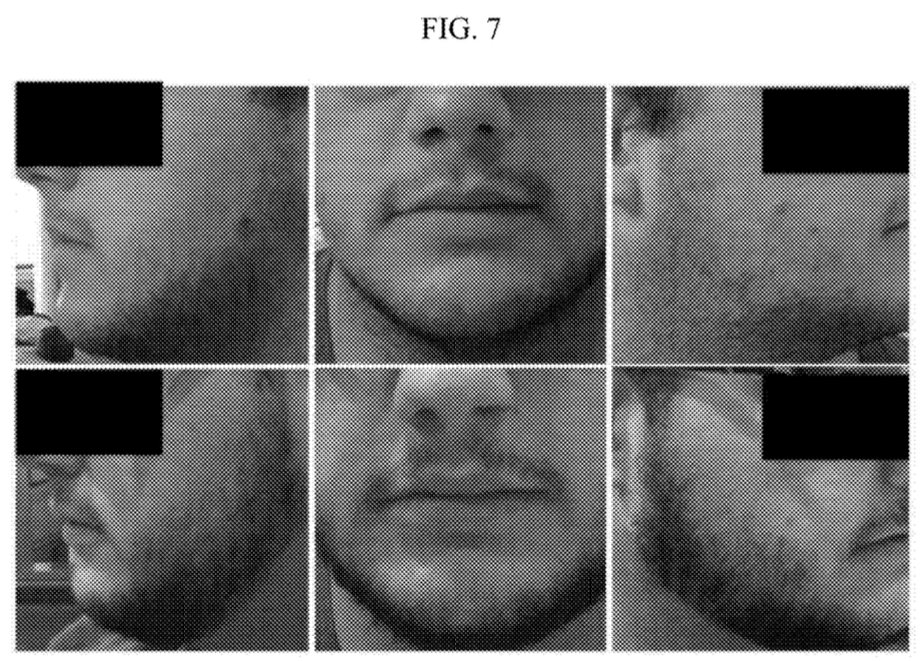 Reverse Gray Hair, Hair Repigmentation - Rapamycin Longevity News