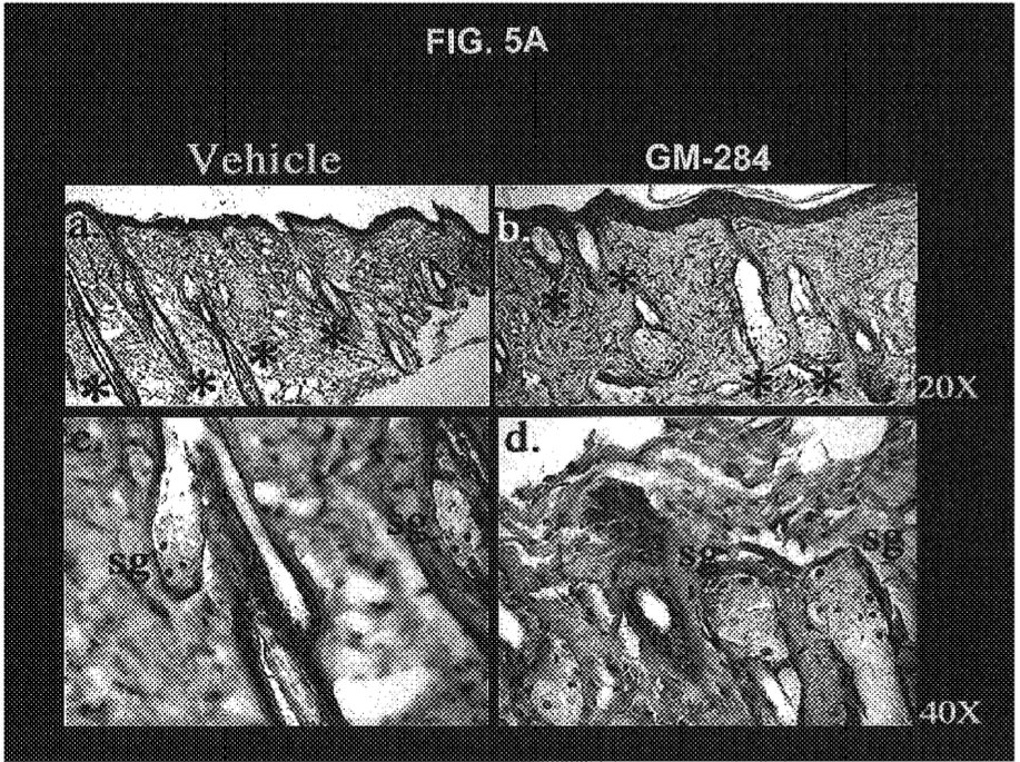 Reverse Gray Hair, Hair Repigmentation - Rapamycin Longevity News